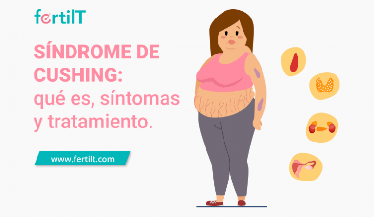 Síndrome de cushing: qué es, síntomas y tratamiento