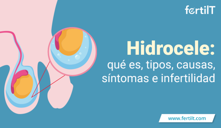Hidrocele: qué es, tipos, causas, síntomas e infertilidad