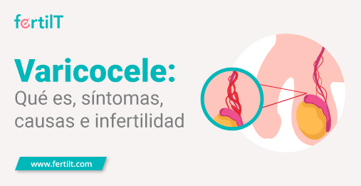 Varicocele: qué es, síntomas causas e infertilidad