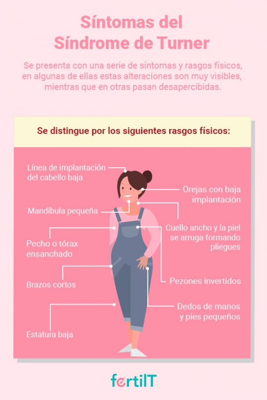 Síndrome de Turner: Síntomas, Embarazo y fertilidad