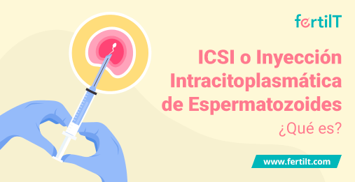 ICSI o Inyección Intracitoplasmática de Espermatozoides ¿Qué es?