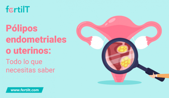 Pólipos endometriales o uterinos: Todo lo que necesitas saber