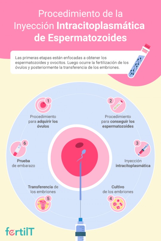 ICSI o Inyección Intracitoplasmática de Espermatozoides ¿Qué es?